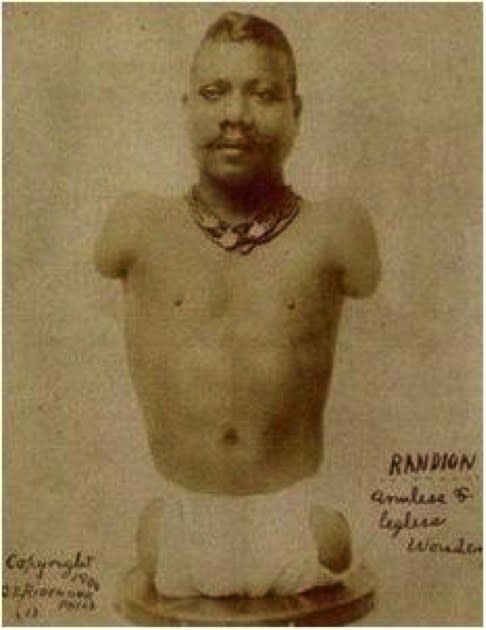 La curiosa Historia de Prince Randian - El Hombre Serpiente