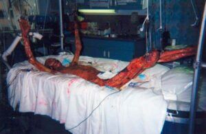 La Terrible y Radioactiva Historia de Hisashi Ouchi